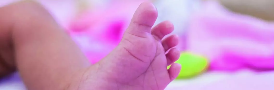 Zaburzenia kończyny dolnej – stopa końsko-szpotawa - Praktyczna ...