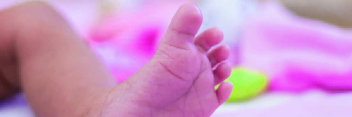 Zaburzenia kończyny dolnej – stopa końsko-szpotawa - Praktyczna ...